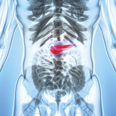 Saphnelo self-injection recommended for EU approval - PharmaTimes